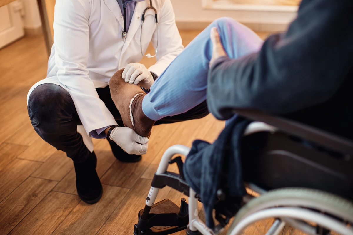 Alabama Amputation Injury Lawyer | Steve Morris Law Group